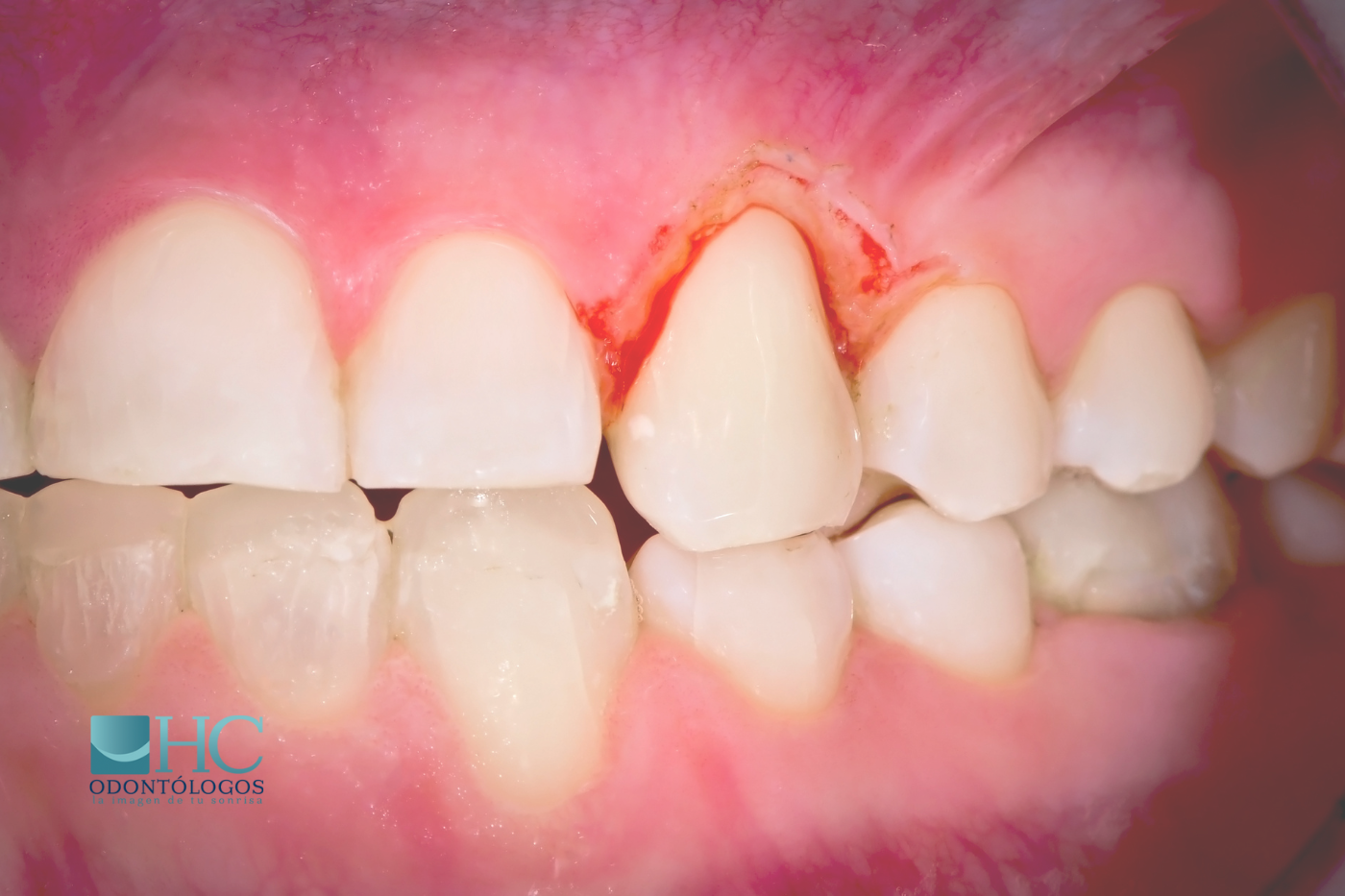 ¿Qué es un periodoncista? Enfermedades y tratamientos - 🦷 Dra. Arelly ...